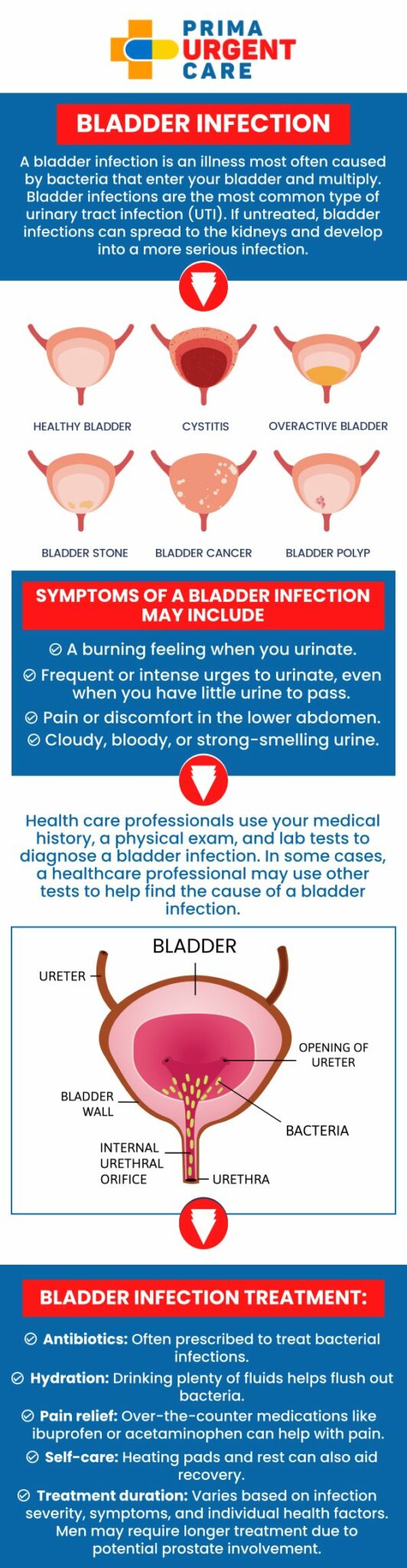 Urgent Care for Bladder Infection Treatment Near Me in Fairfax, VA