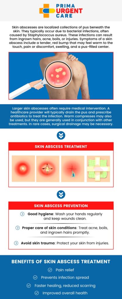 Abscess Healing Stages – What to Expect During Recovery